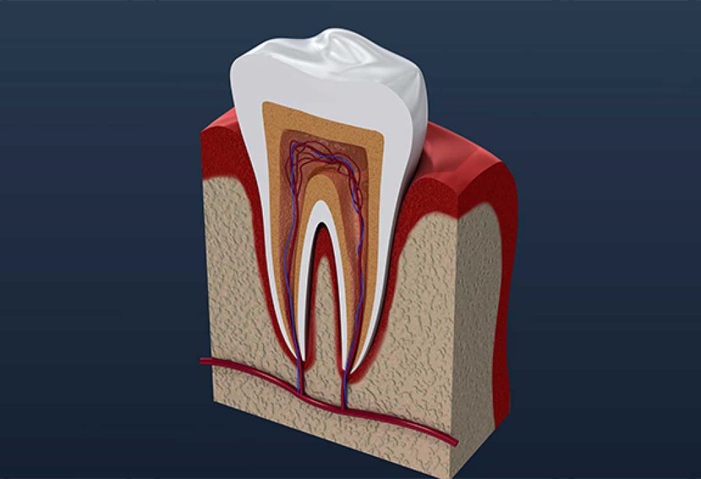 Endodontics - Dr. Karen Kassabian